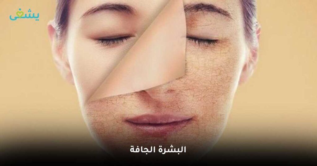 تعرفي على أنواع البشرة وصفاتها وكيفية العناية بكل نوع منهم